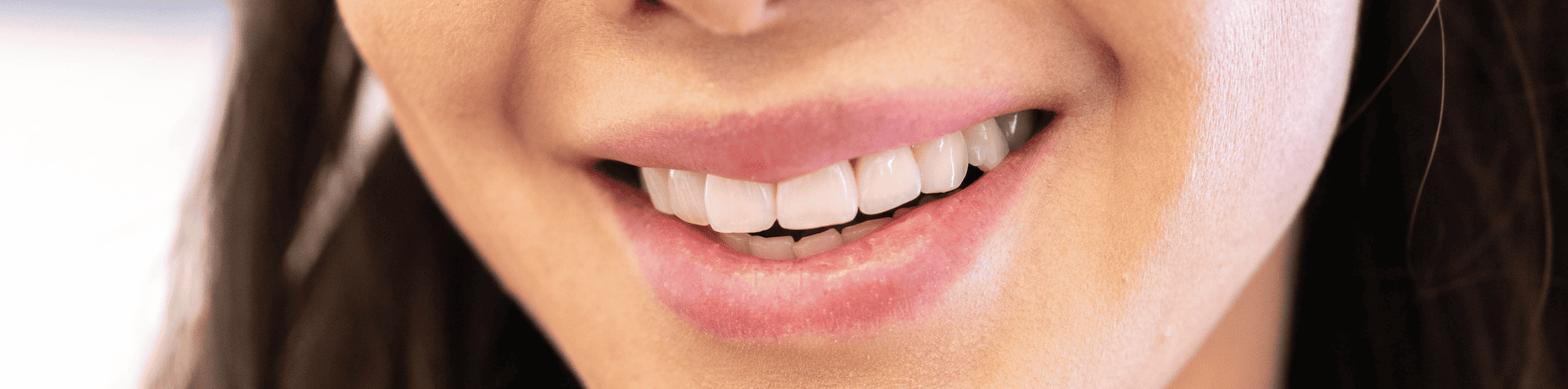 Teeth Whitening - All of Your Important Questions Answered